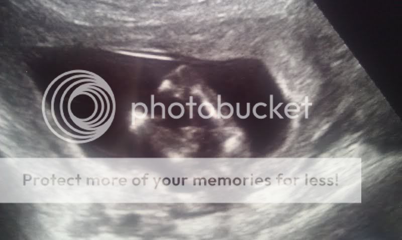 Turtle and techs...ambiguous genitalia? | BabyCenter